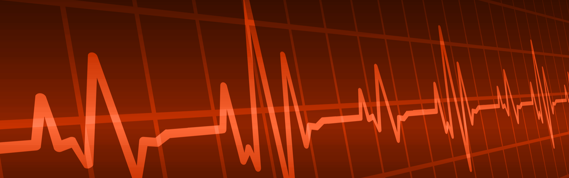 Monitoring Strip Scanning Services | Monitoring Strip Scanning Company